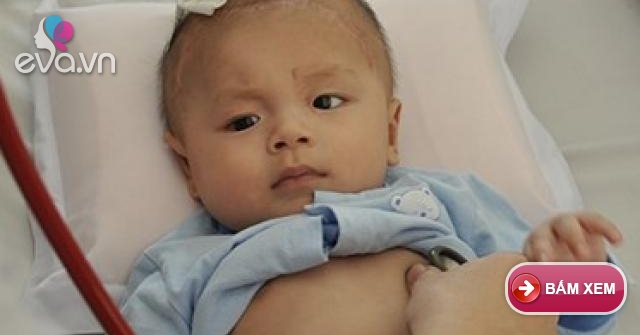 Em bé bị dao đâm vào đầu xuất viện sau lần mổ thứ ba