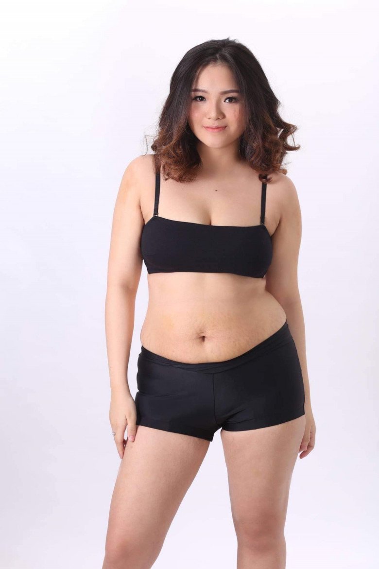 Yeye Nhật Hạ sau sinh chằng chịt vết rạn, dị ứng khắp người, nỗ lực giảm 38kg lấy lại vóc dáng ...