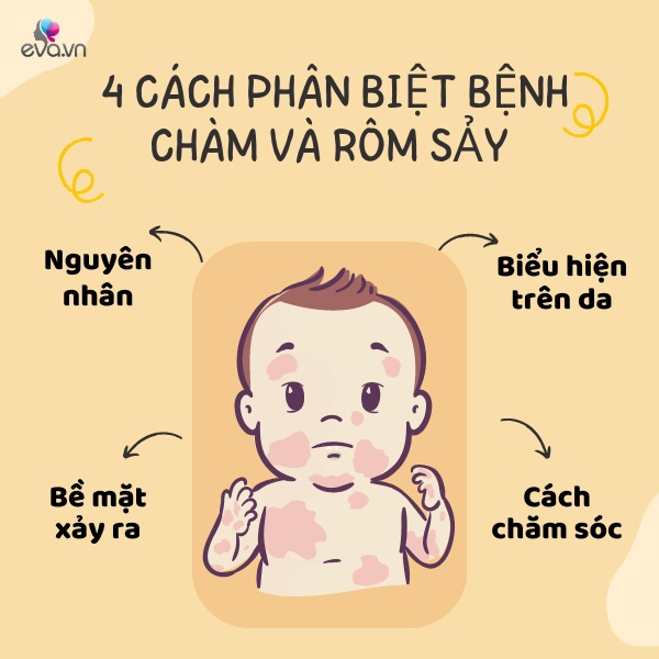 Thời tiết trên 30 độ C liên tục khiến trẻ sơ sinh bị rôm sảy, bác sĩ ...