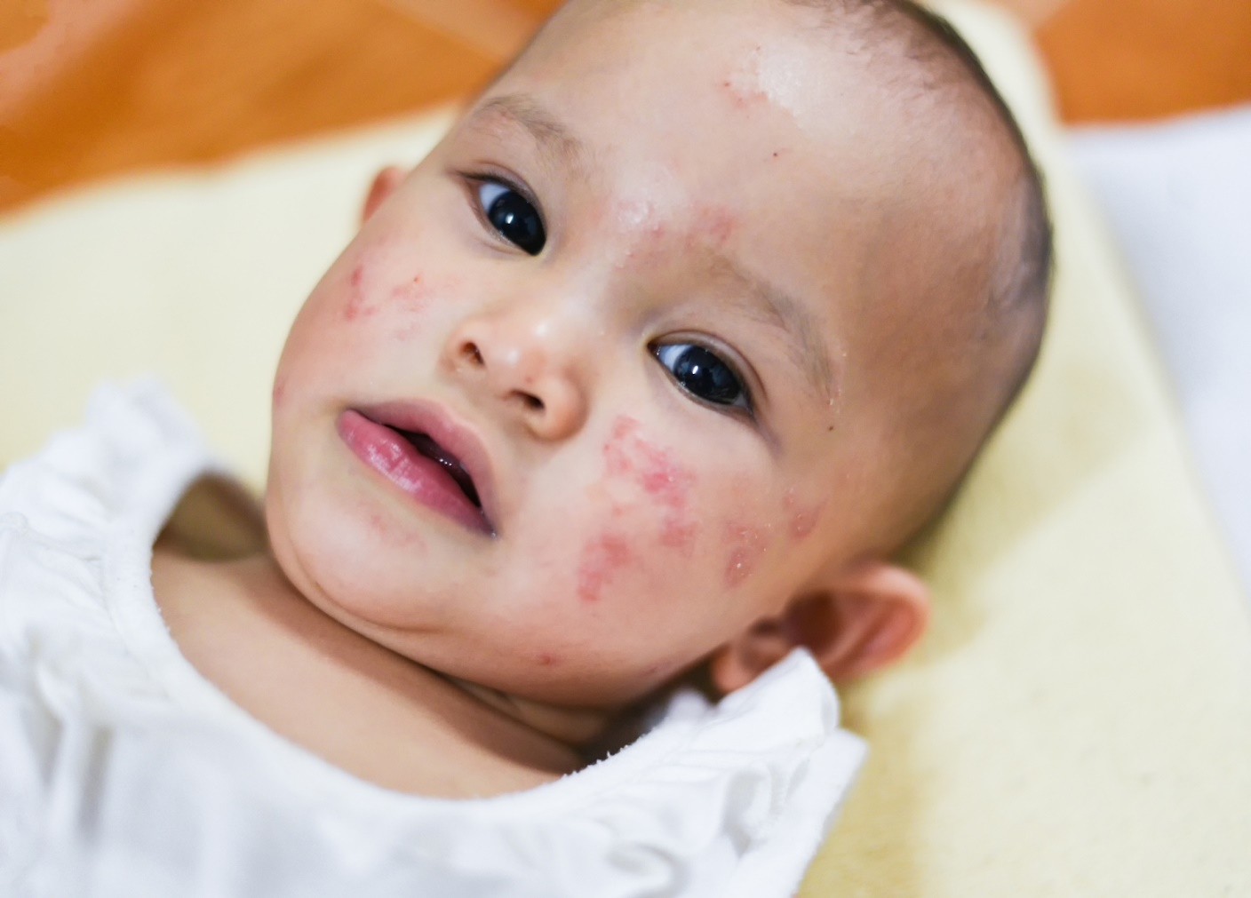 Kem Đa Năng Nano Curcumin Mulskin - Bảo bối "xử gọn” các vấn đề da liễu ...