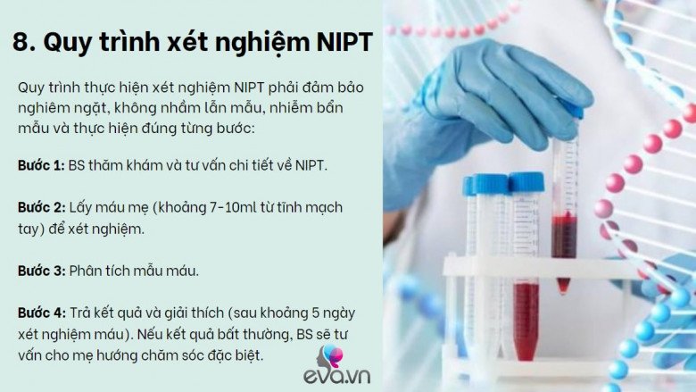 Tất tần tật về xét nghiệm NIPT sàng lọc dị tật thai nhi và những lý do mẹ bầu nên làm