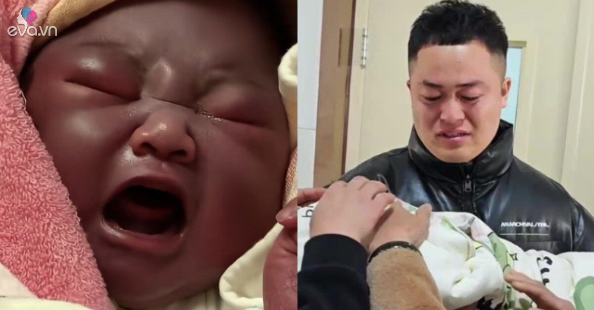 Bố mẹ hoảng sợ khi con sơ sinh chào đời da nửa đen nửa tím, bác sĩ tức ...