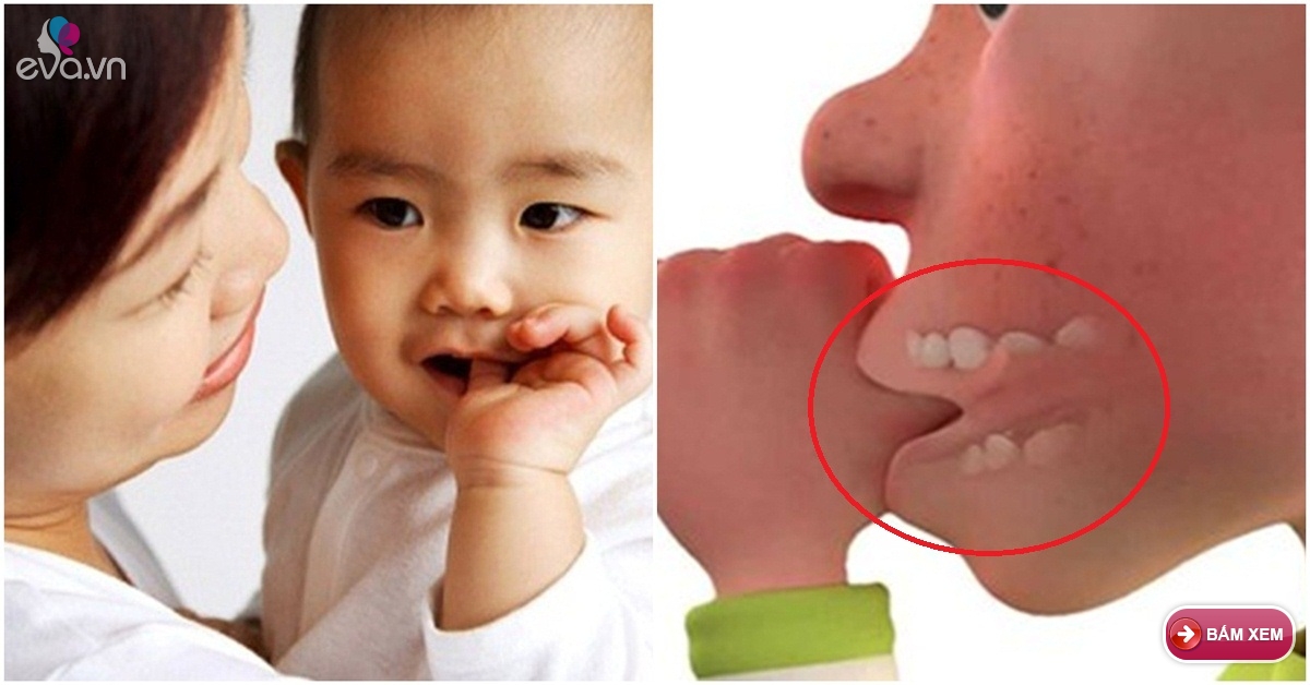Trẻ sơ sinh mút tay: Con mút tay mẹ cứ để yên mà không biết nó hại tới ...