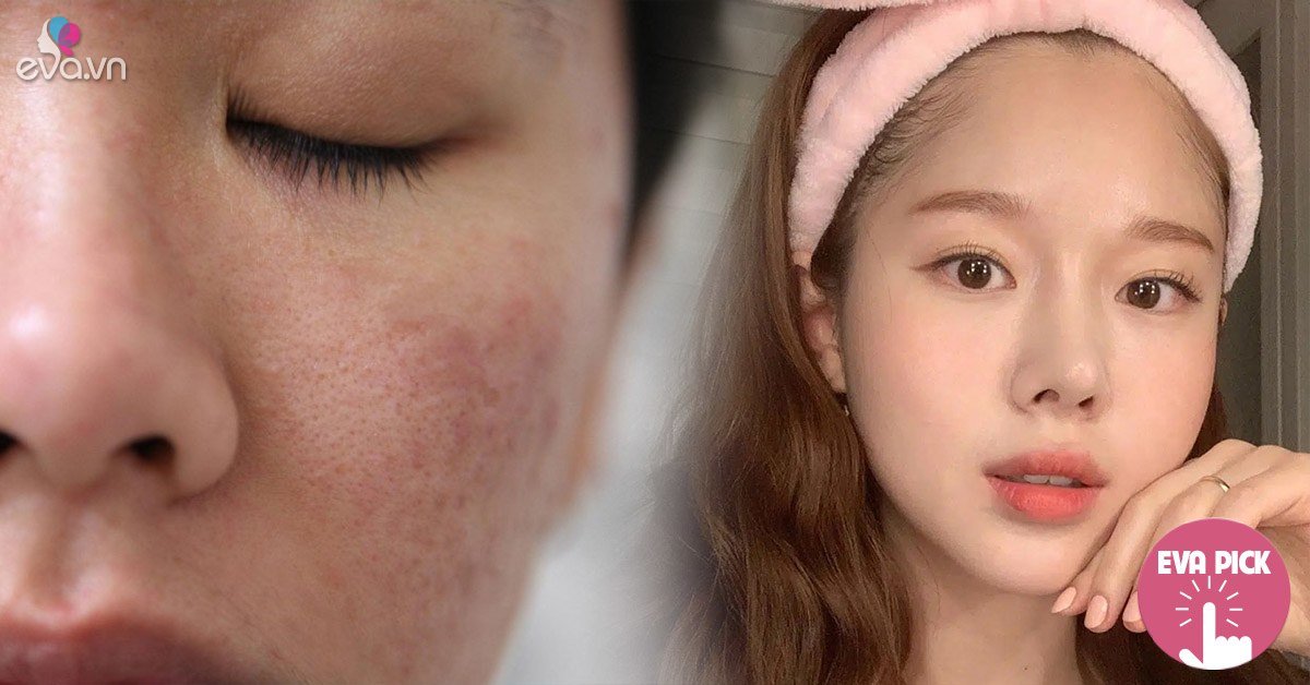 Eva Pick: Tưởng là chất độc tàn phá dung nhan, nhưng càng dùng 9 loại ...