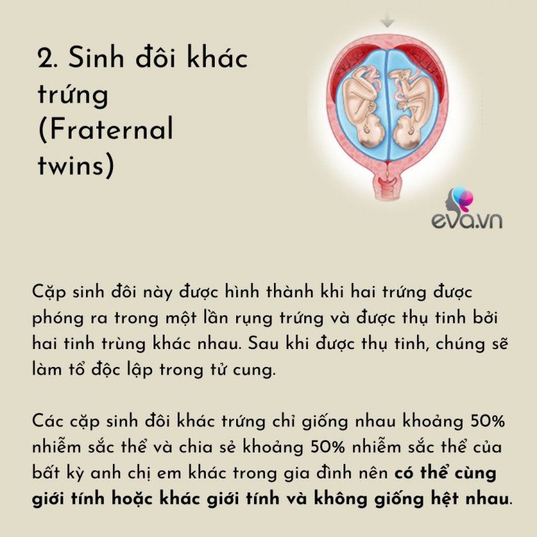 Không phải trẻ sinh đôi nào cũng giống nhau bởi có 7 kiểu sinh đôi mà ...