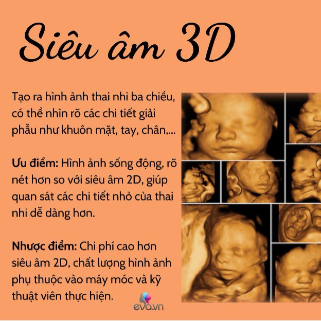 Mọi điều bà bầu cần biết về siêu âm 3D và 4D