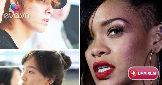 Người nổi tiếng cũng da xấu, mặt mụn dù có make up đậm