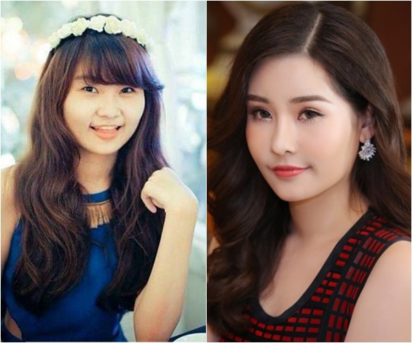 Dù đã rút sụn mũi, dáng mũi của Lệ Quyên vẫn thon gọn bất ngờ
