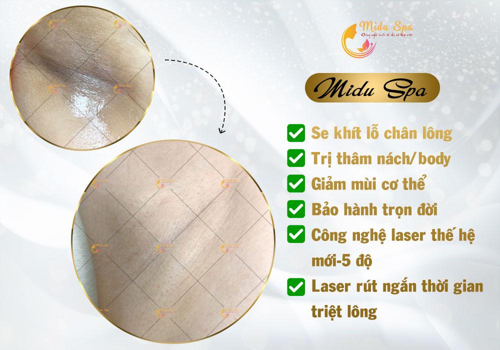 Midu Spa – Trung tâm chuyên triệt lông hiệu quả tại TP.HCM