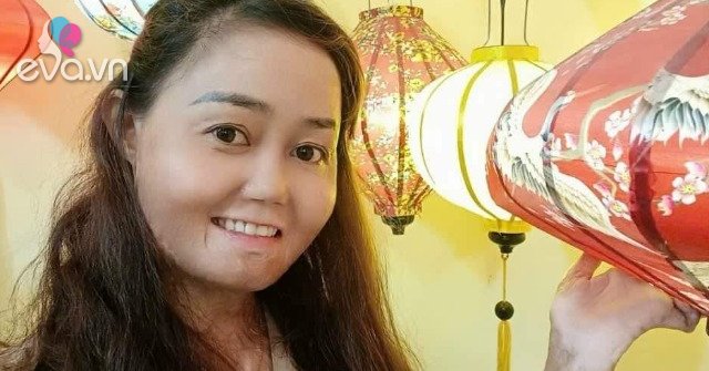 Bất ngờ cuộc sống mới của người phụ nữ Phú Yên bị chồng cũ thiêu sống ...