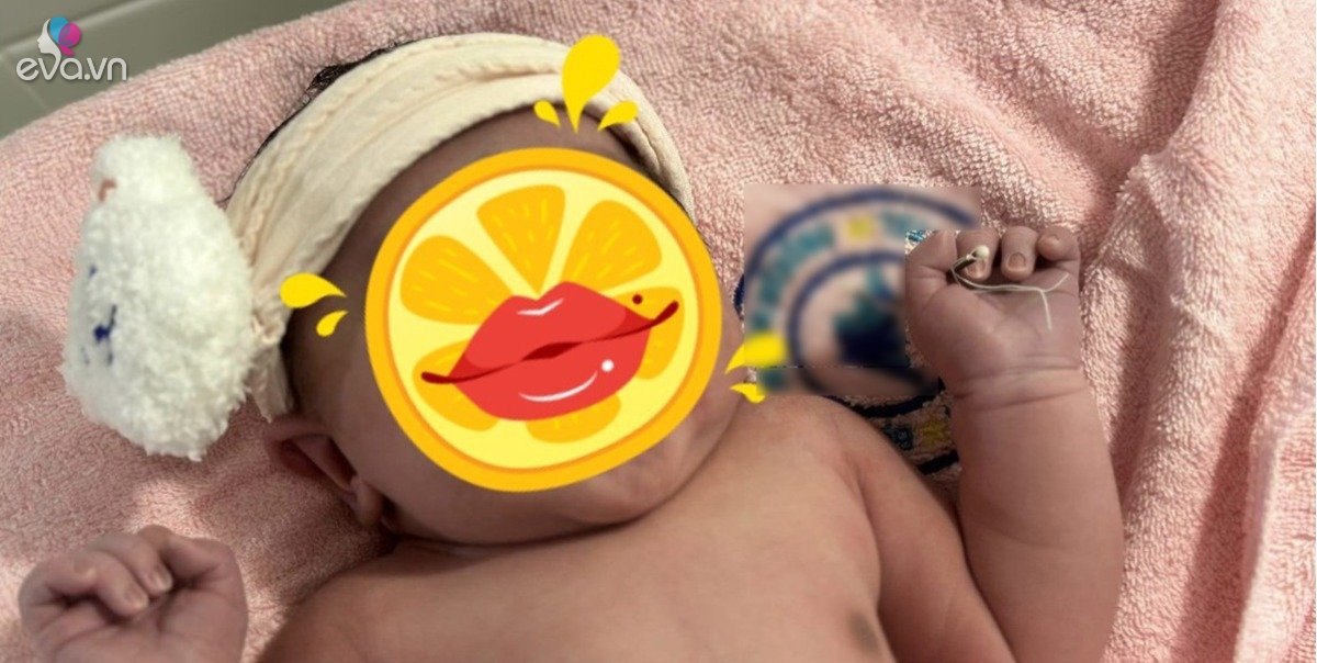 Em bé 3,7kg chào đời cùng vòng tránh thai của mẹ trong màng bánh nhau