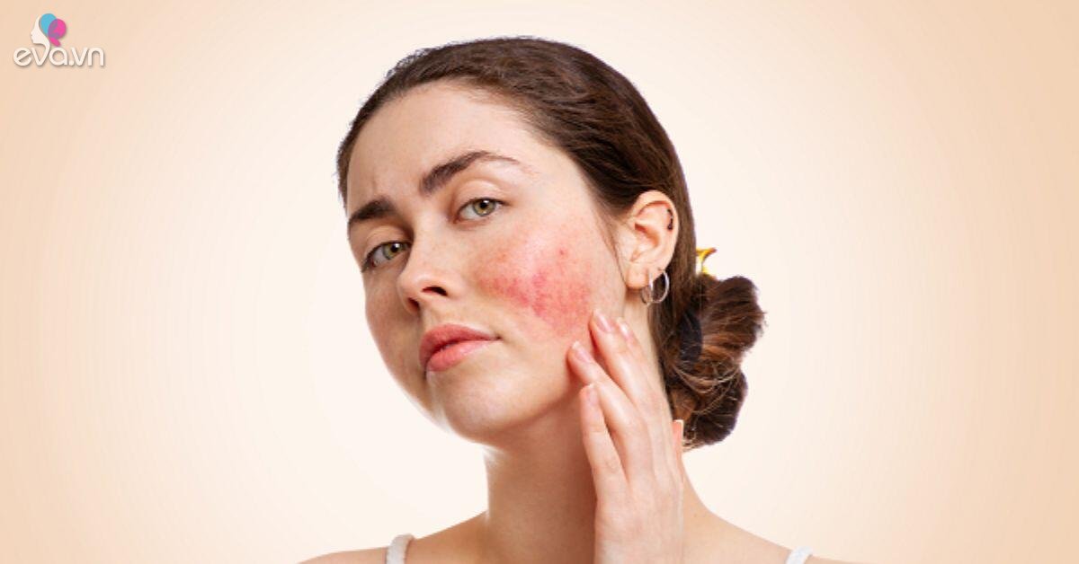 9 thay đổi trên da, ít người chú ý đến lại là dấu hiệu cảnh báo bệnh ...