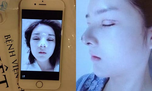 Lilly Luta | Hot girl Lilly Luta trước và sau phẫu thuật