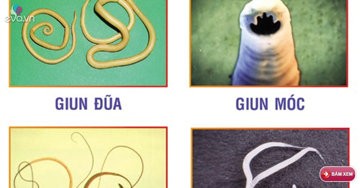 Đừng để giun sán làm tổ trong cơ thể chỉ vì tiếc 20.000 đồng