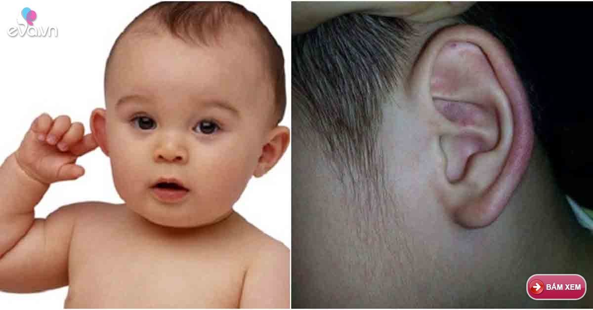 Nuôi con: Đừng véo tai con nữa, bằng không sẽ nguy hiểm đến tính mạng