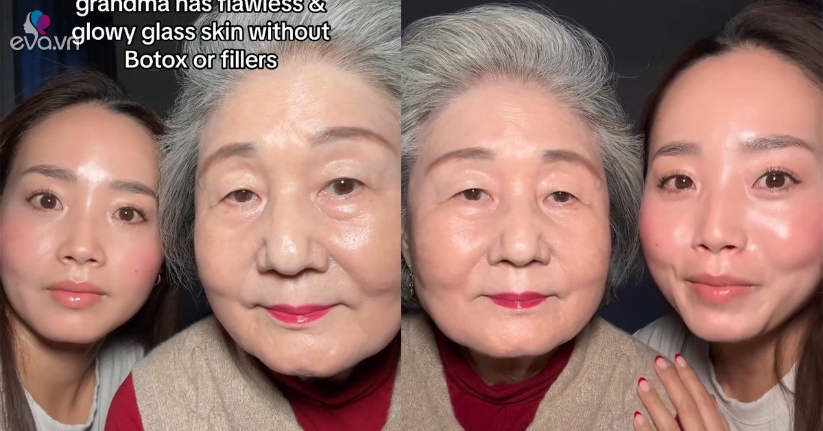 Bà ngoại tuổi 80 chăm da hút 14 triệu mắt xem, botox hay filler không ...